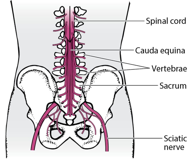 Image:Cauda Equina Syndrome-Merck Manual Consumer Version
