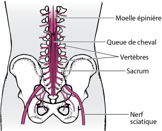Syndrome de la queue de cheval - Troubles du cerveau, de la moelle ...
