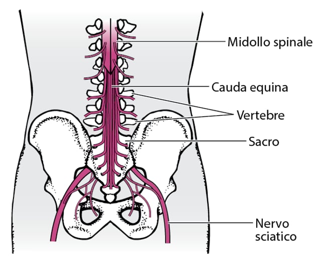 Image:Sindrome della cauda equina-Manuale MSD, versione per i pazienti