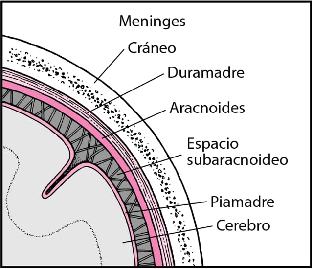 Absceso epidural intracraneal y empiema subdural - Enfermedades ...