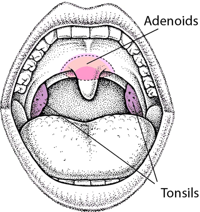 Image:Locating the Tonsils and Adenoids-Merck Manual Consumer Version