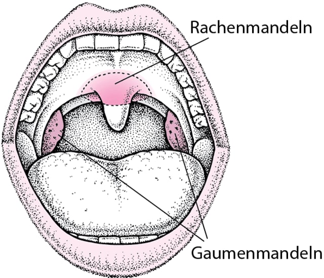 Image:Lage der Gaumen- und Rachenmandeln-MSD Manual Ausgabe für Patienten