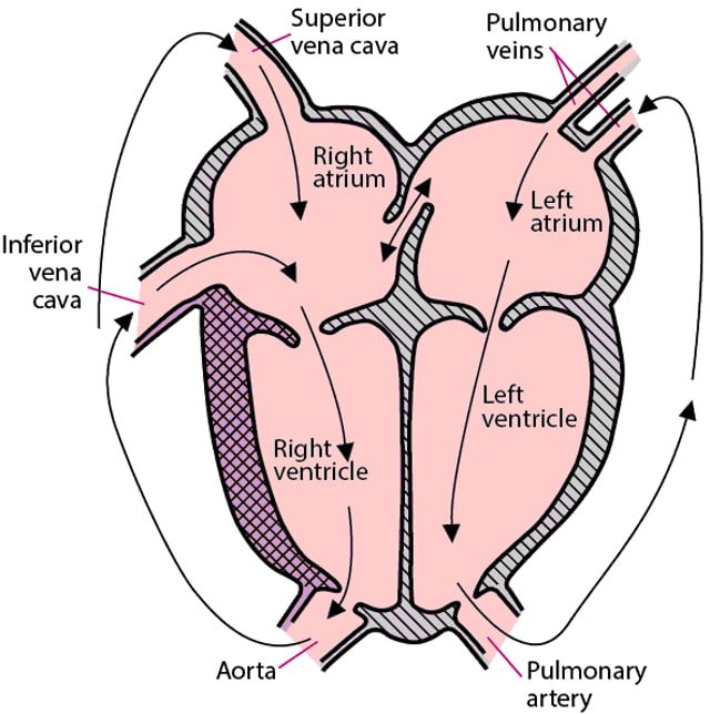 Image:Transposition of the Great Arteries-MSD Manual Consumer Version