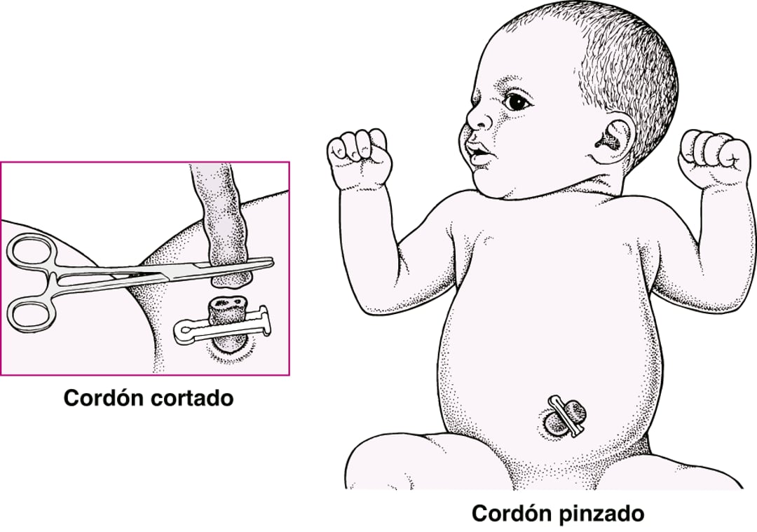 Image:Corte del cordón umbilical-Manual MSD versión para público general