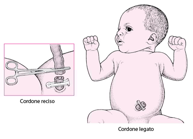 Image:Taglio del cordone ombelicale-Manuale MSD, versione per i pazienti