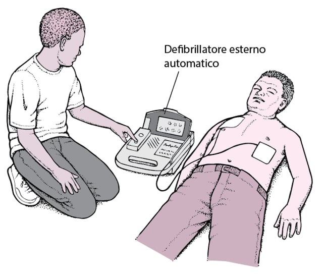 Image:Defibrillatore automatico esterno: mettere in moto il cuore ...