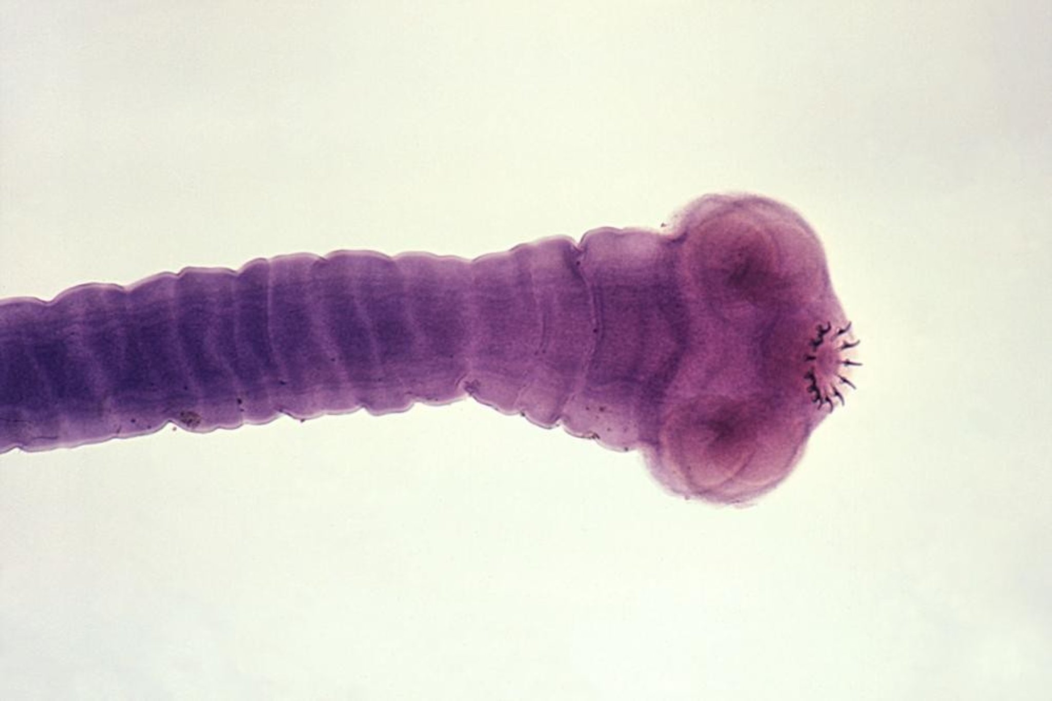 Tapeworm Infection Tapeworm Infection Merck Manual Consumer Version Tapeworm Infection Tapeworm Infection Merck Manual Consumer Version