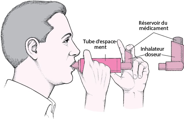 Image:Utilisation d’un aérosol-doseur avec un tube d’espacement-Manuels ...