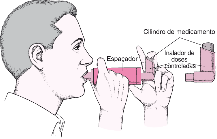 Medicamentos para prevenir e tratar a asma - Distúrbios pulmonares e ...