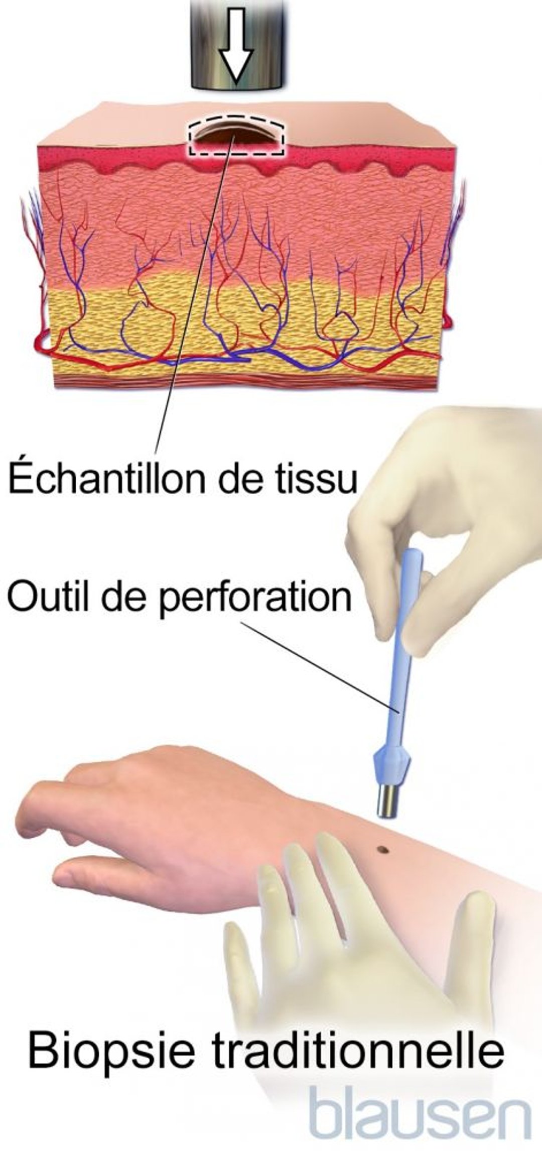 Diagnostic des troubles de la peau - Diagnostic des troubles de la peau ...