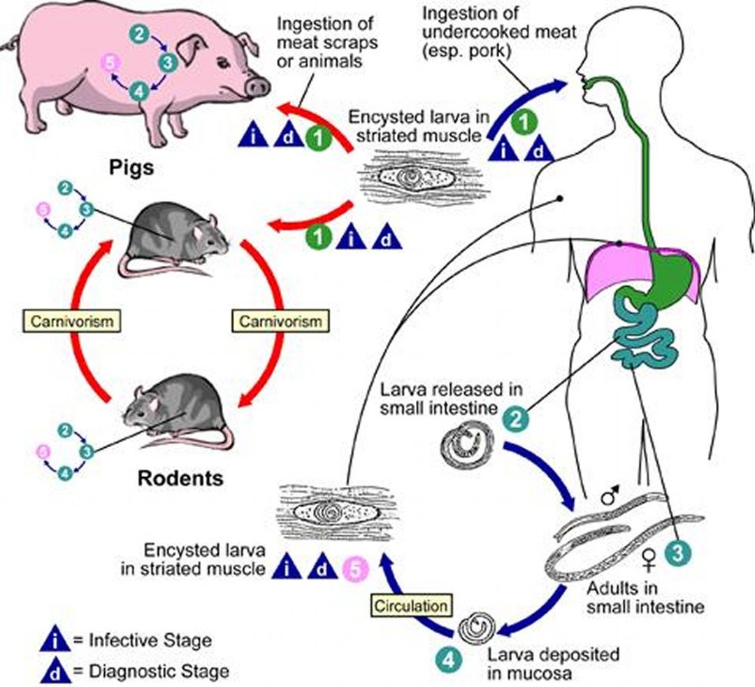 Trichinose - Infections - Manuels MSD pour le grand public