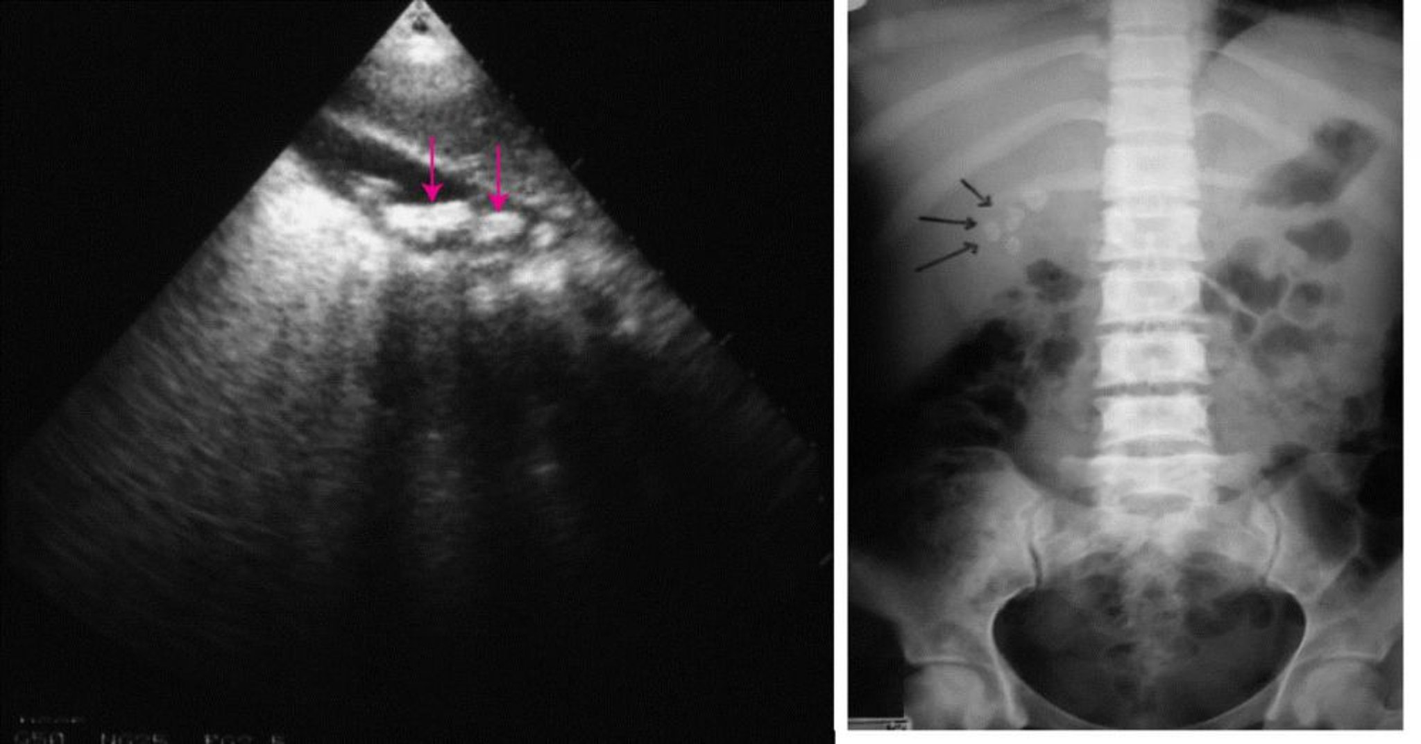Imaging Tests Of The Liver And Gallbladder Imaging Tests Of The Liver