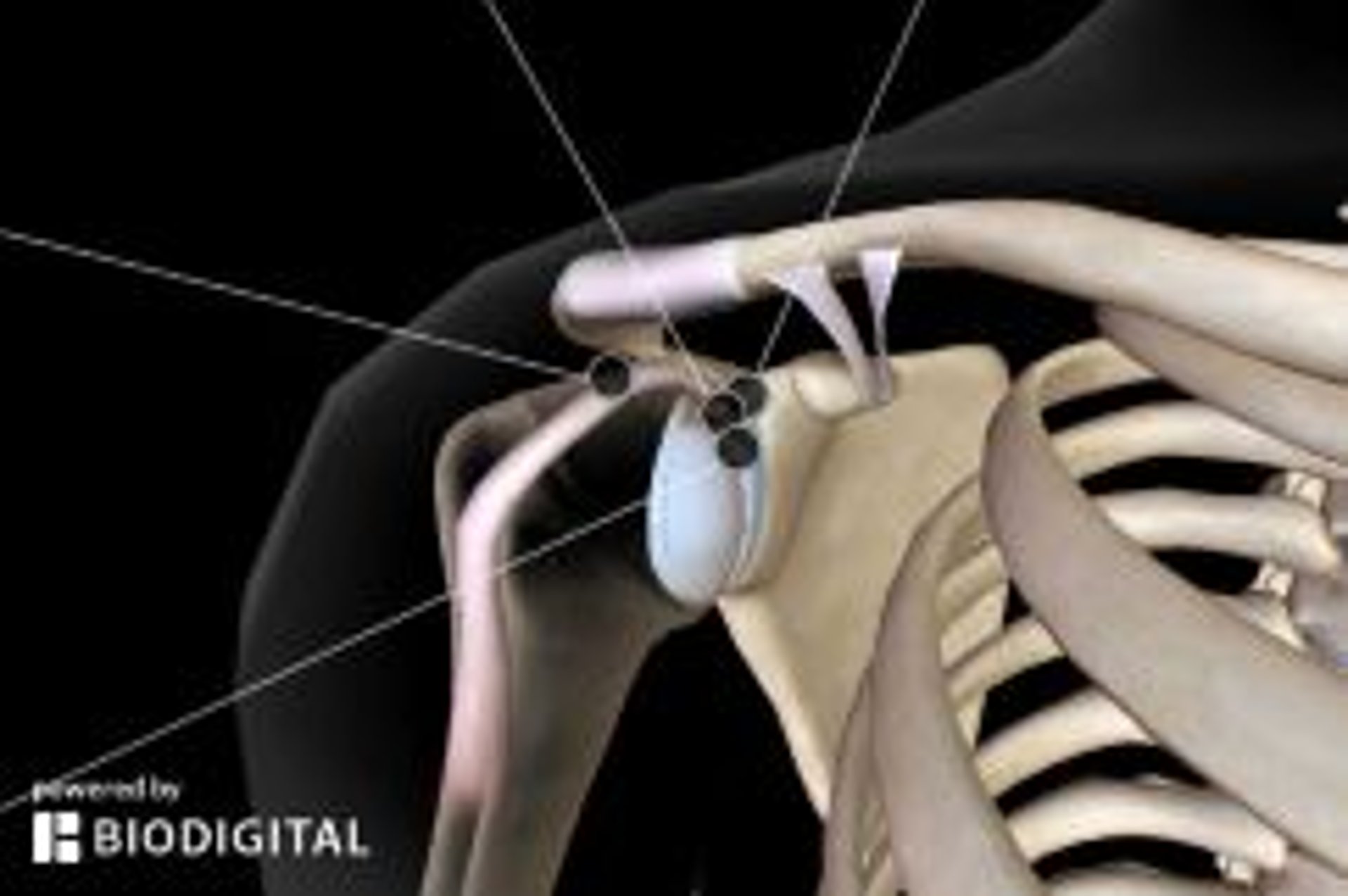 3D Model: Glenoid Labral Tear-Merck Manual Professional Edition