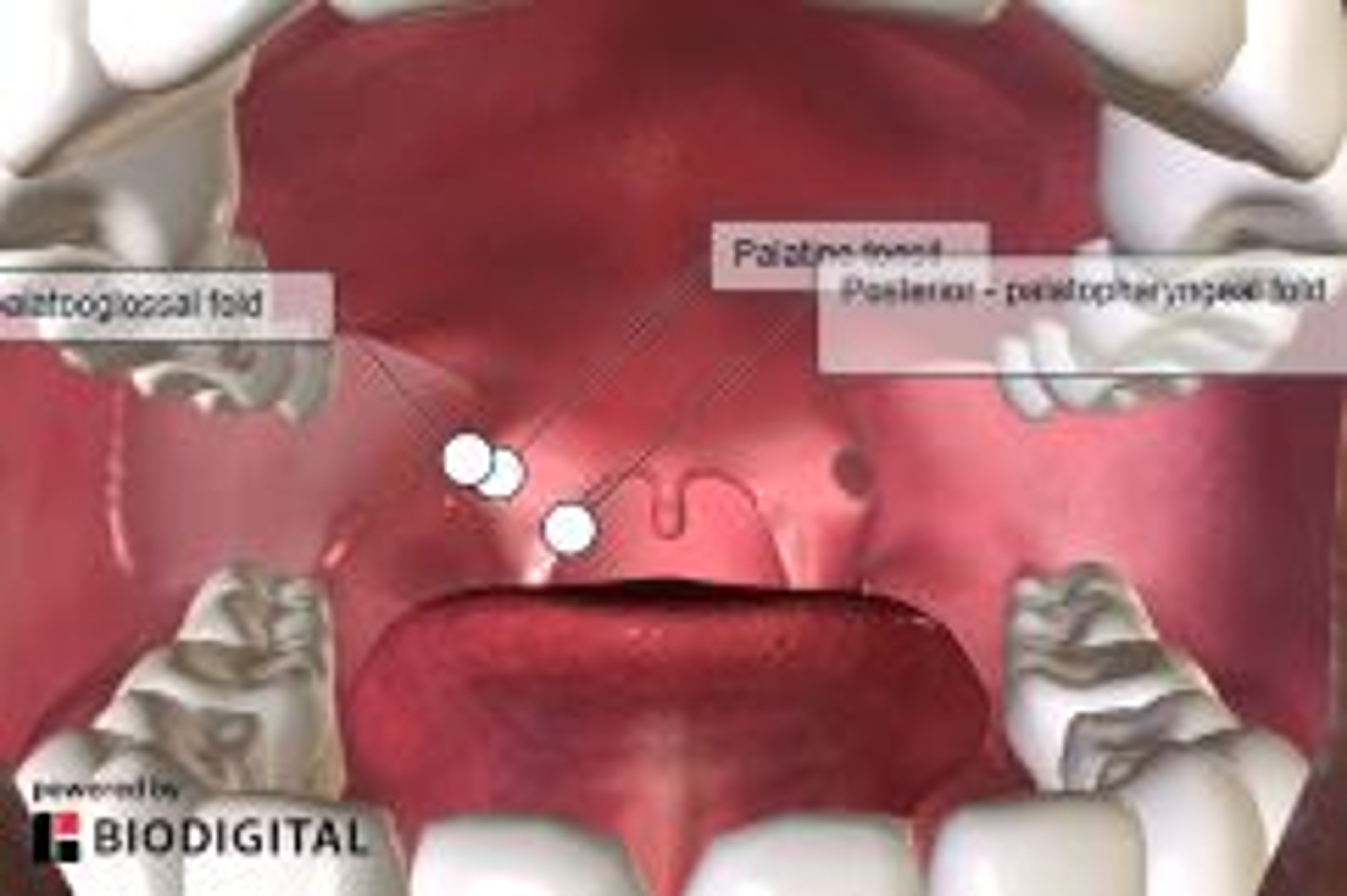 3D Model: Anatomy of the Tonsillar Bed-Merck Manual Professional Edition