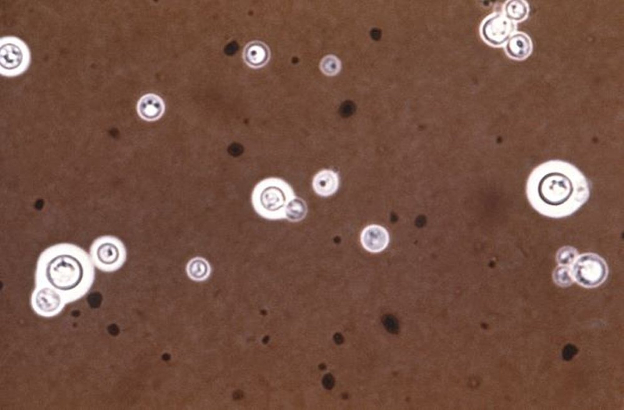 Image:Фарбування індійською тушшю (Cryptococcus neoformans)-MSD Manual ...