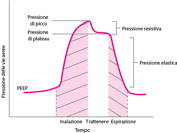 Panoramica sulla ventilazione meccanica - Medicina di terapia intensiva ...