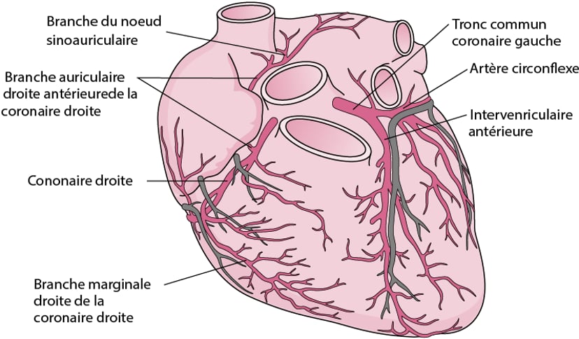 Revue générale des coronaropathies - Troubles cardiovasculaires ...