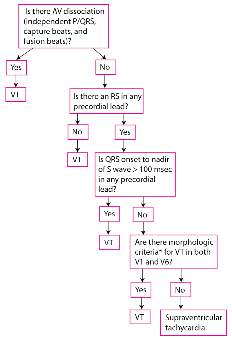 Ventricular Tachycardia (VT) - Cardiovascular Disorders - MSD Manual ...