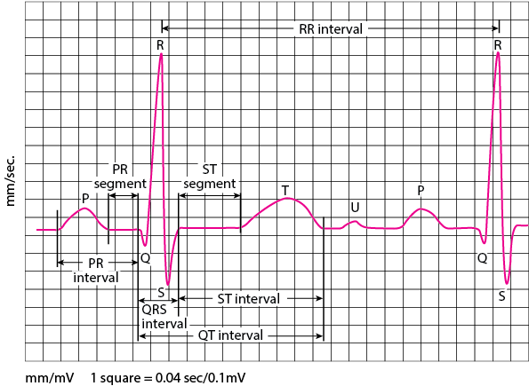 Electrocardiography - Cardiovascular Disorders - MSD Manual ...