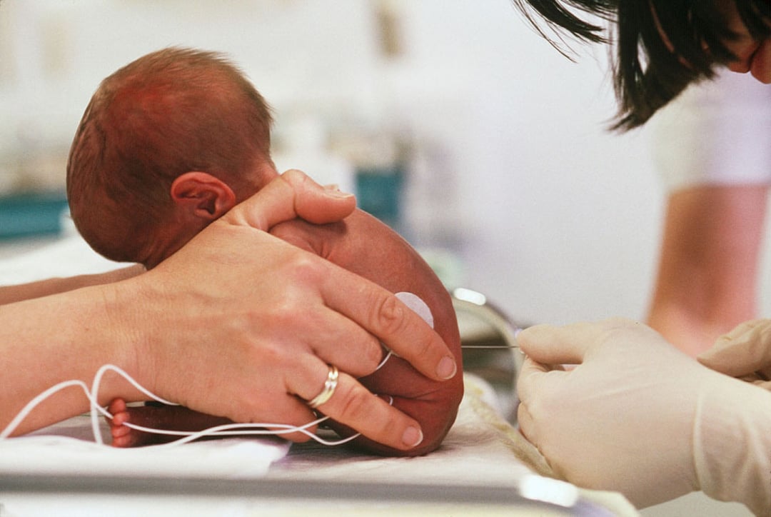 How To Do Lumbar Puncture - Neurologic Disorders - Merck Manual ...