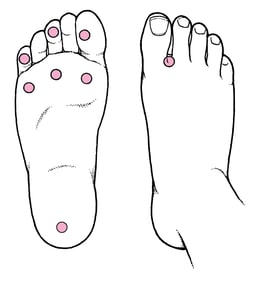 Image:Diabetic Foot Screening-MSD Manual Professional Edition