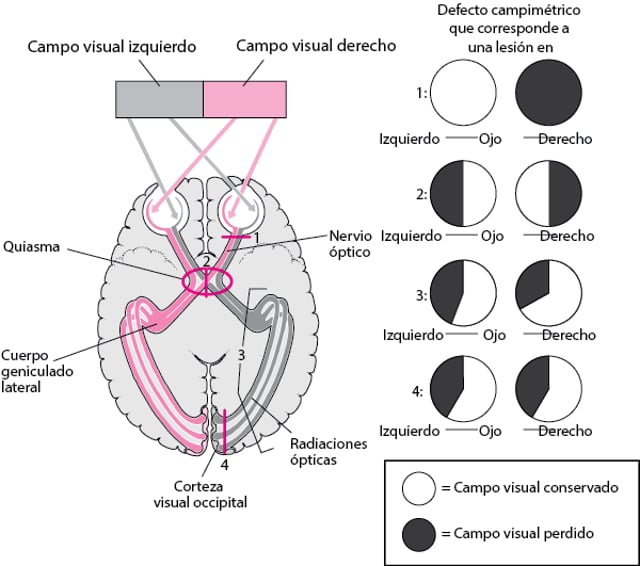 El tracto óptico - Trastornos oftálmicos - Manual MSD versión para ...