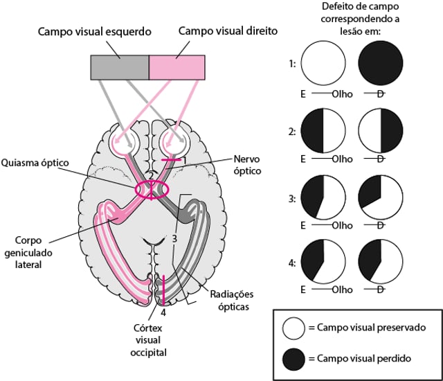 Via óptica - Via óptica - Manuais MSD edição para profissionais