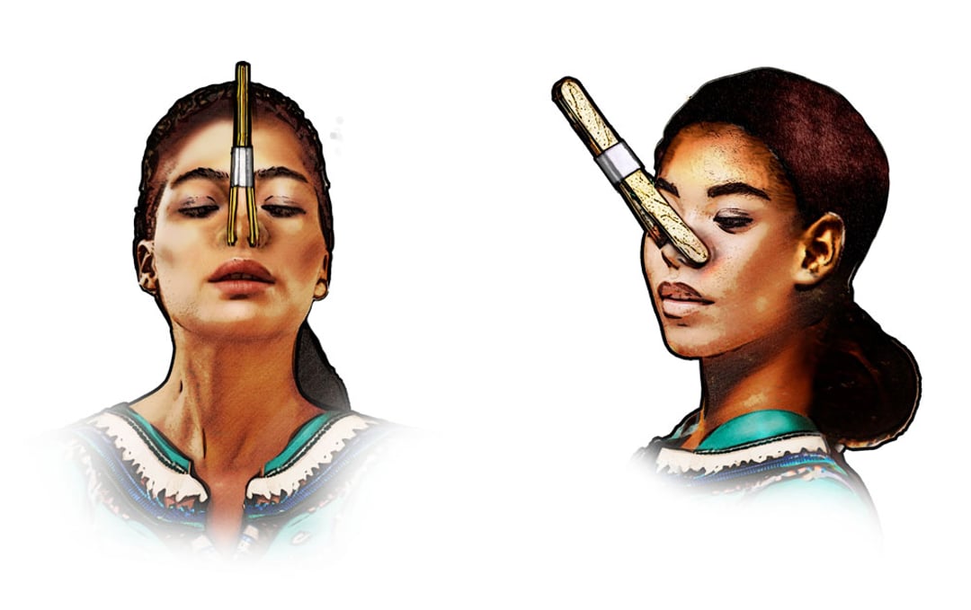 Epistaxis Epistaxis Msd Manual Professional Edition