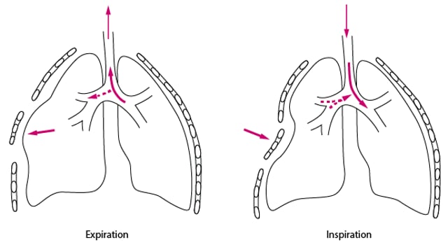 Flail Chest - Flail Chest - Merck Manual Professional Edition
