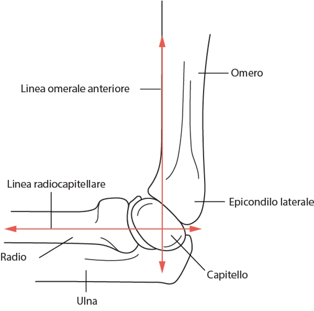 Image:Linea omerale anteriore e linea radiocapitellare-Manuali MSD ...