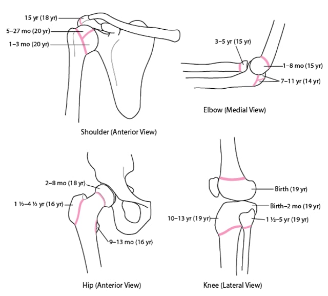 Pediatric Physeal (Growth Plate) Fractures - Injuries; Poisoning - MSD ...