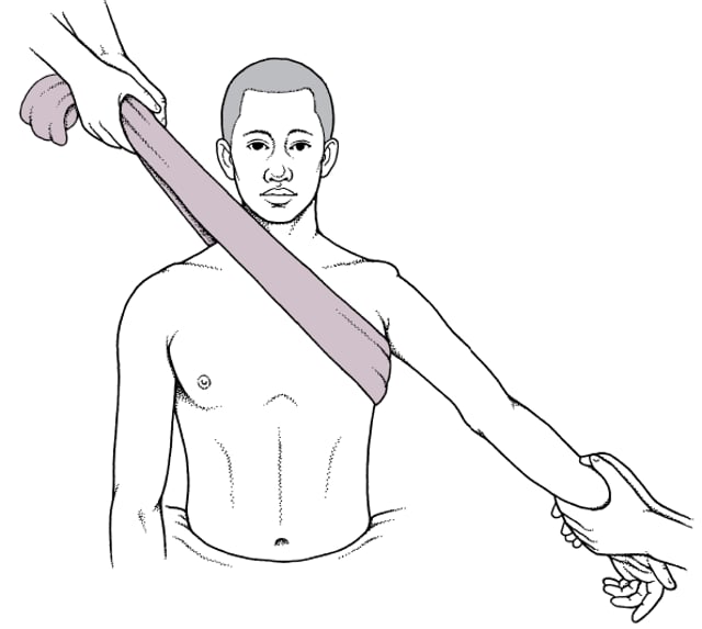 Image:Traction-countertraction technique for reducing anterior shoulder ...