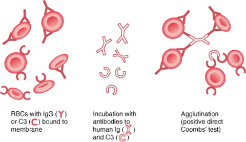 Image:Direct Antiglobulin (Direct Coombs) Test-MSD Manual Professional ...