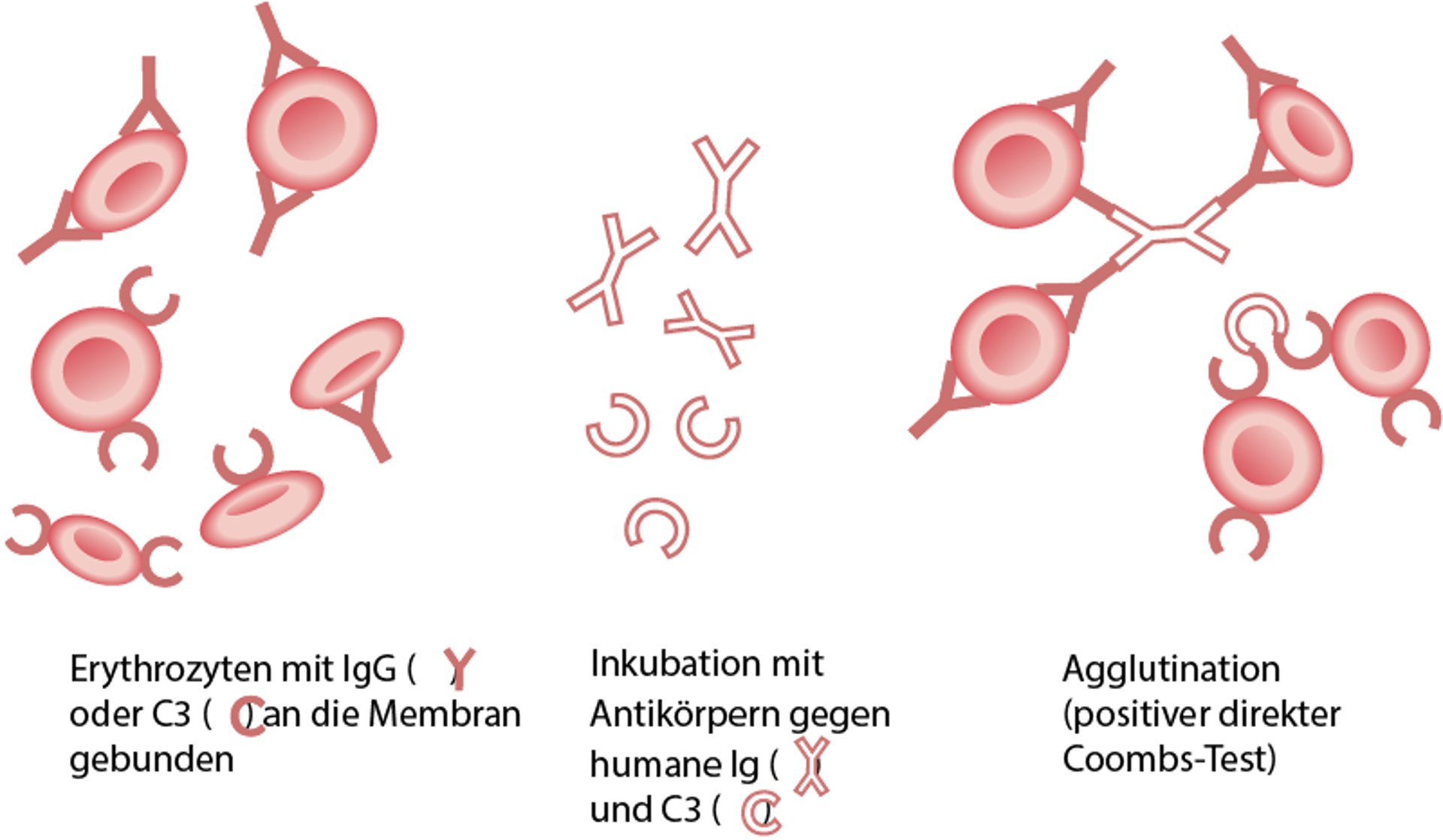 Image:Direkter Antiglobulin-(Direkter Coombs)-Test-MSD Manual Profi-Ausgabe