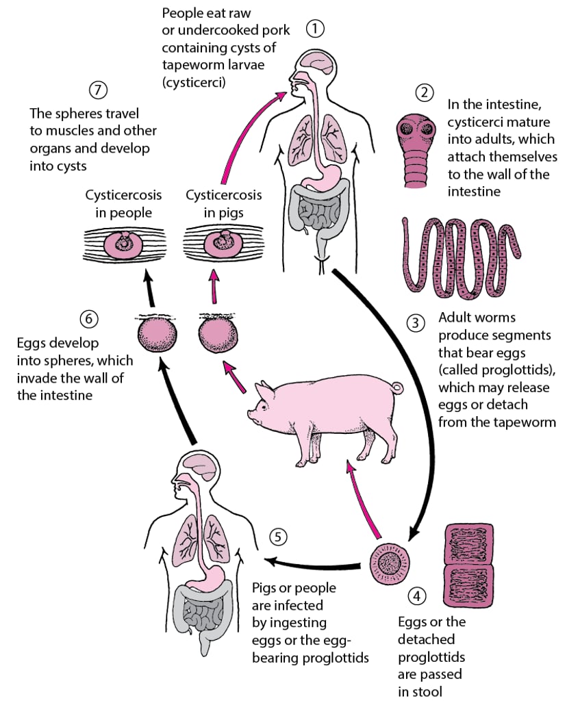 Taenia Solium (Pork Tapeworm) Infection and Cysticercosis - Infectious ...