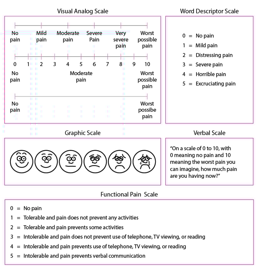 Evaluation of Pain - Neurologic Disorders - MSD Manual Professional Edition