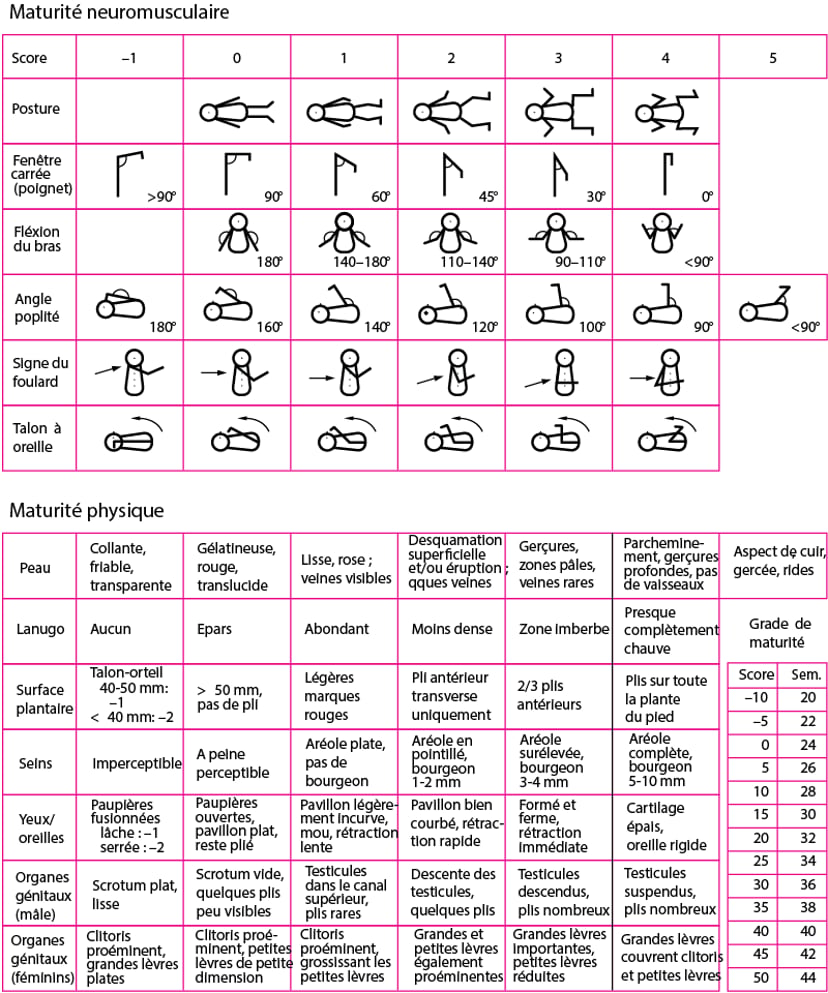 Examen clinique du nouveau-né - Examen clinique du nouveau-né - Édition ...