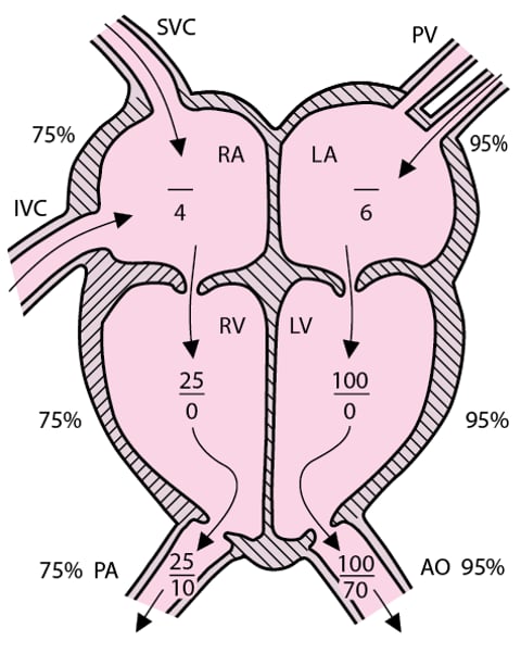 Image:Normal circulation with representative right and left cardiac ...