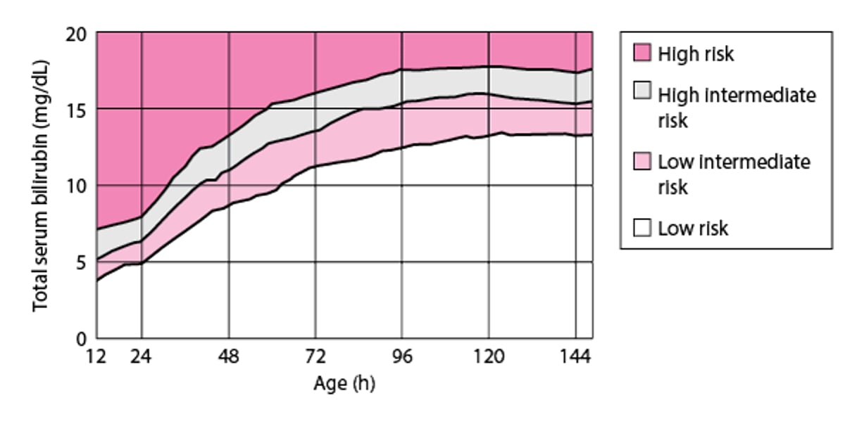 Гіпербілірубінемія новонароджених - Педіатрія - MSD Manual Professional ...
