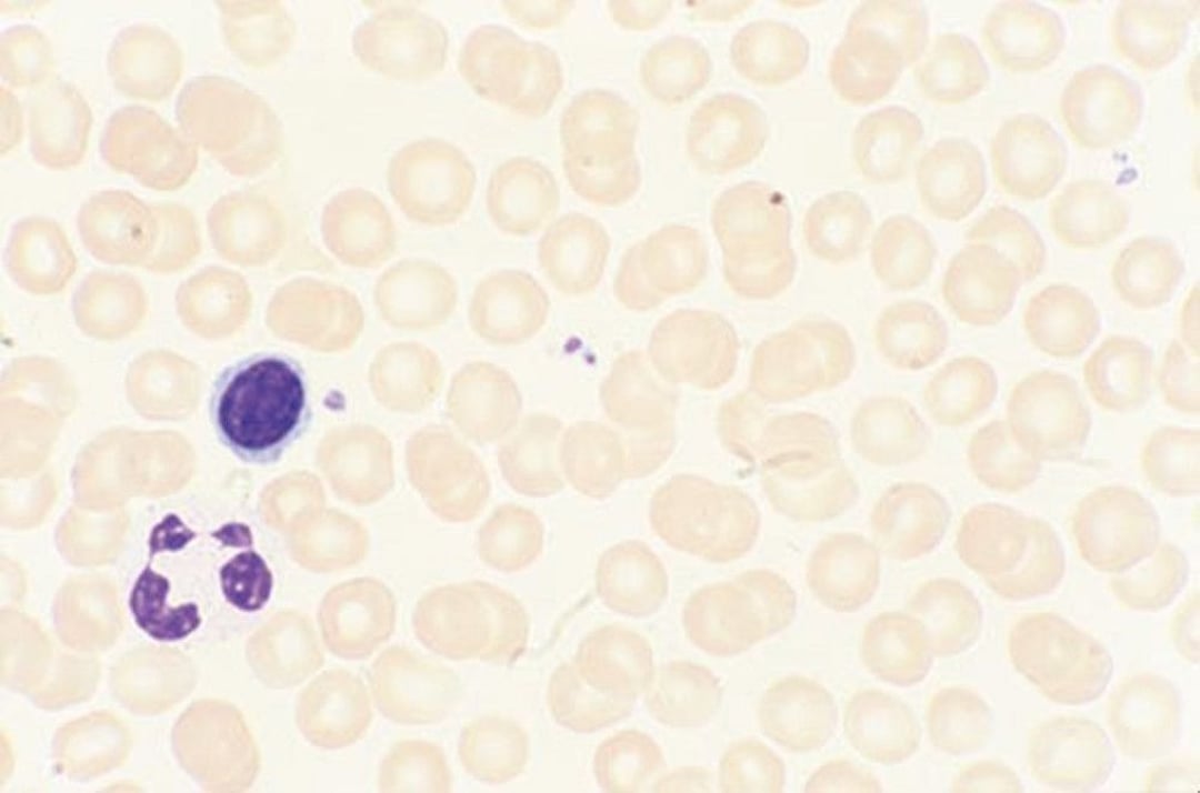 Image:Peripheral Blood Smear, Normal-MSD Manual Professional Edition