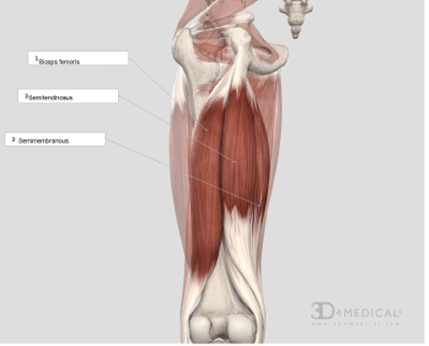 Hamstring Strain - Injuries; Poisoning - MSD Manual Professional Edition