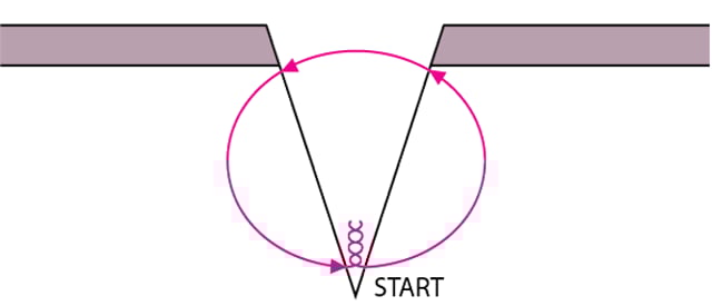Lacerations - Lacerations - MSD Manual Professional Edition