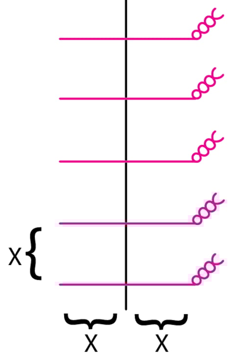 Lacerations - Lacerations - MSD Manual Professional Edition