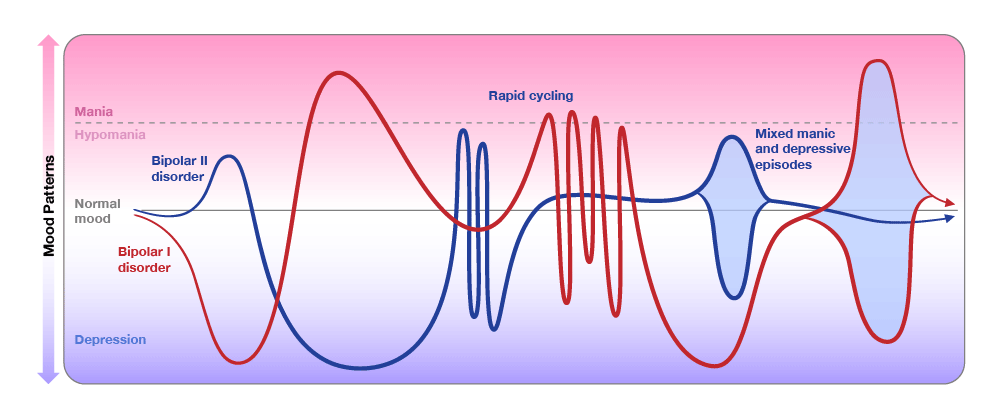 Image:Episodic Patterns in Bipolar I and Bipolar II Disorders-MSD ...