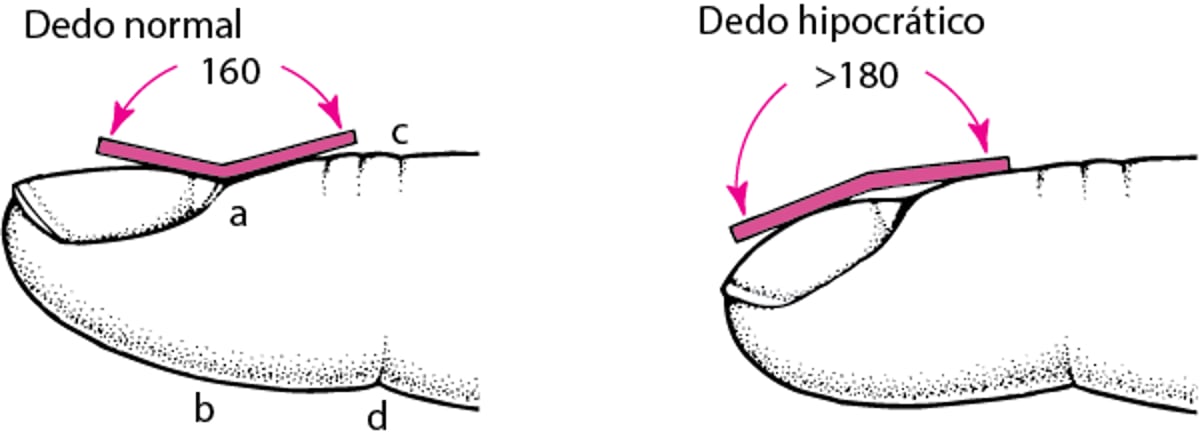 Image:Medición del hipocratismo digital-Manual MSD versión para ...