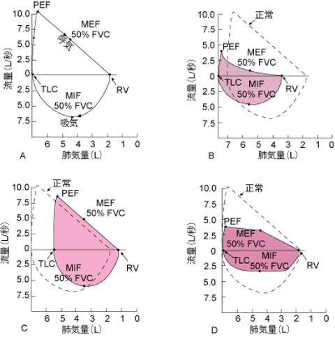 Image:フローボリューム曲線-MSDマニュアル プロフェッショナル版