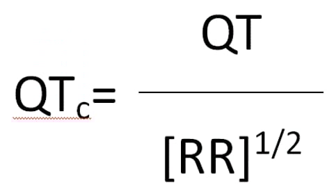 心律失常概述 - 心血管疾病 - MSD诊疗手册专业版
