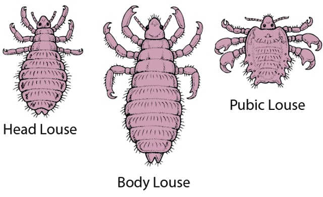 Lice - Dermatologic Disorders - Merck Manual Professional Edition