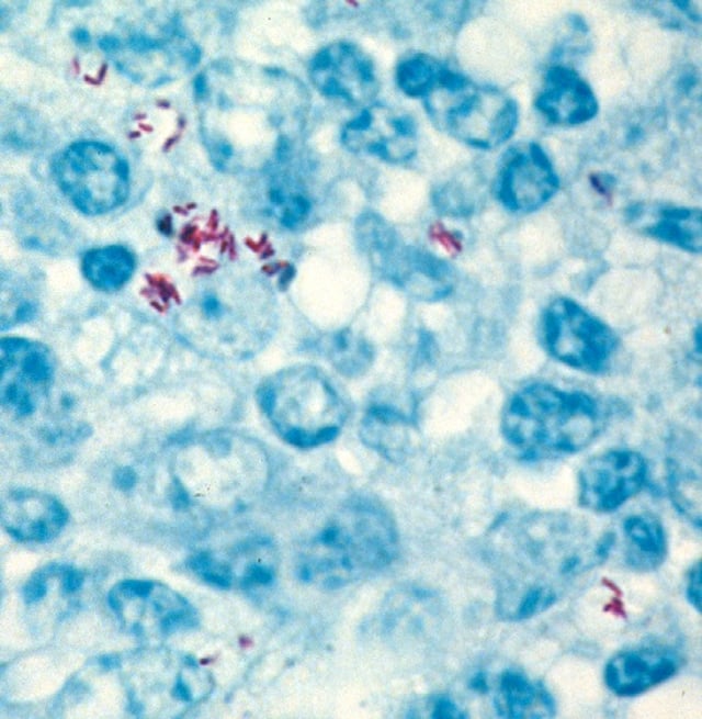 Paratuberculosis in Ruminants - Digestive System - MSD Veterinary Manual