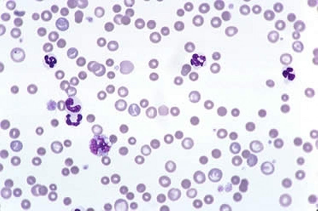 Clinical Hematology - Clinical Pathology and Procedures - MSD ...